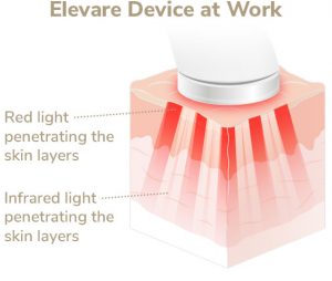 Wrinkle-Reduction & Facial Rejuvenation Device | Elevare Skin